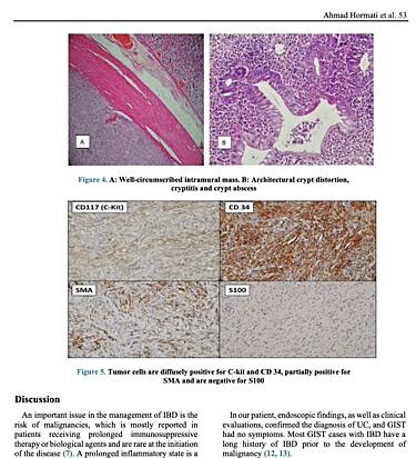 Coexistence of Gastric Gastrointestinal Stromal Tumor and Ulcerative ...