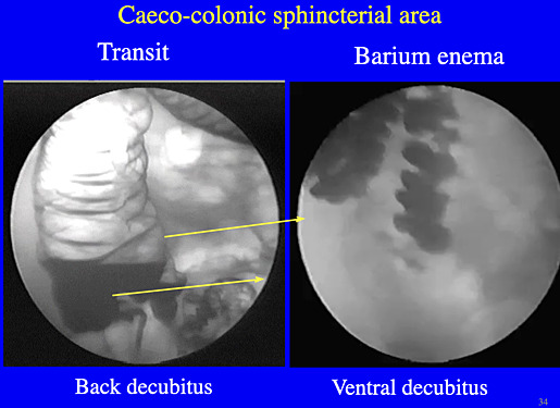Role of Sphincters of the Oesogastrointestinal Tract • Publication ...