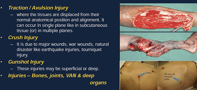 Wound Types & Management • Publication • MEDtube.net