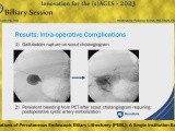 Complications of Percutaneous Endoscopic Biliary Lithectomy (PEBL) A ...