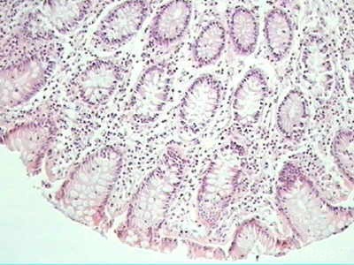 Trichuris Trichuris (whipworm) (19 of 19) • Image • MEDtube.net