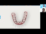 IPR Techniques with an Orthodontist • Video • MEDtube.net