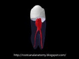 Mandibular First Premolar - Root Canal Anatomy - 3 • Video • MEDtube.net